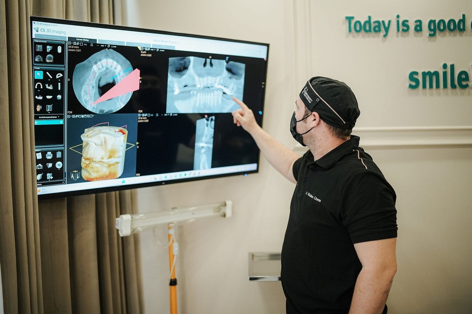 Avantajele implanturilor subperiostale